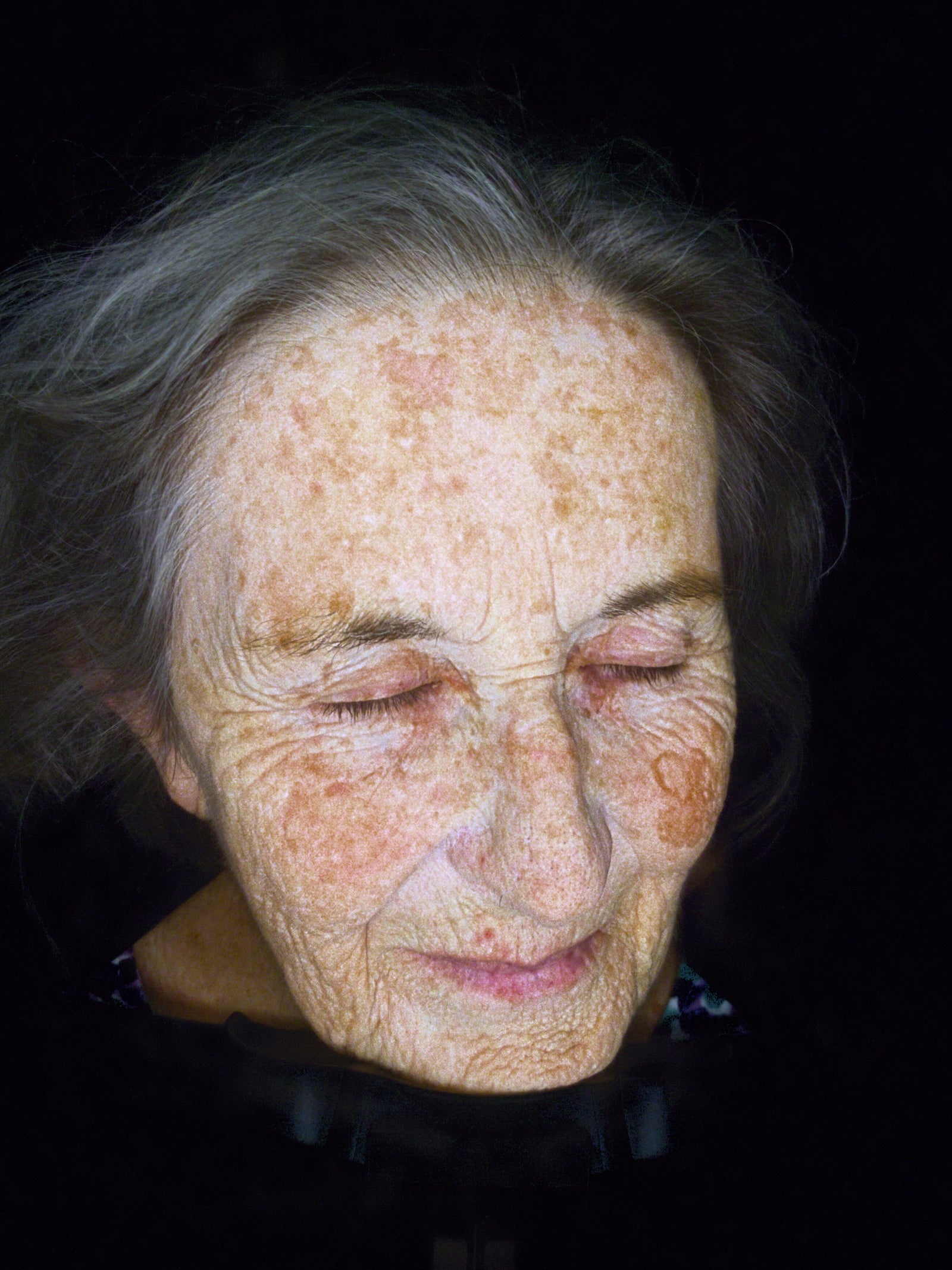 Pigmentation & Discoloration – Hawthorne Skin & Beauty