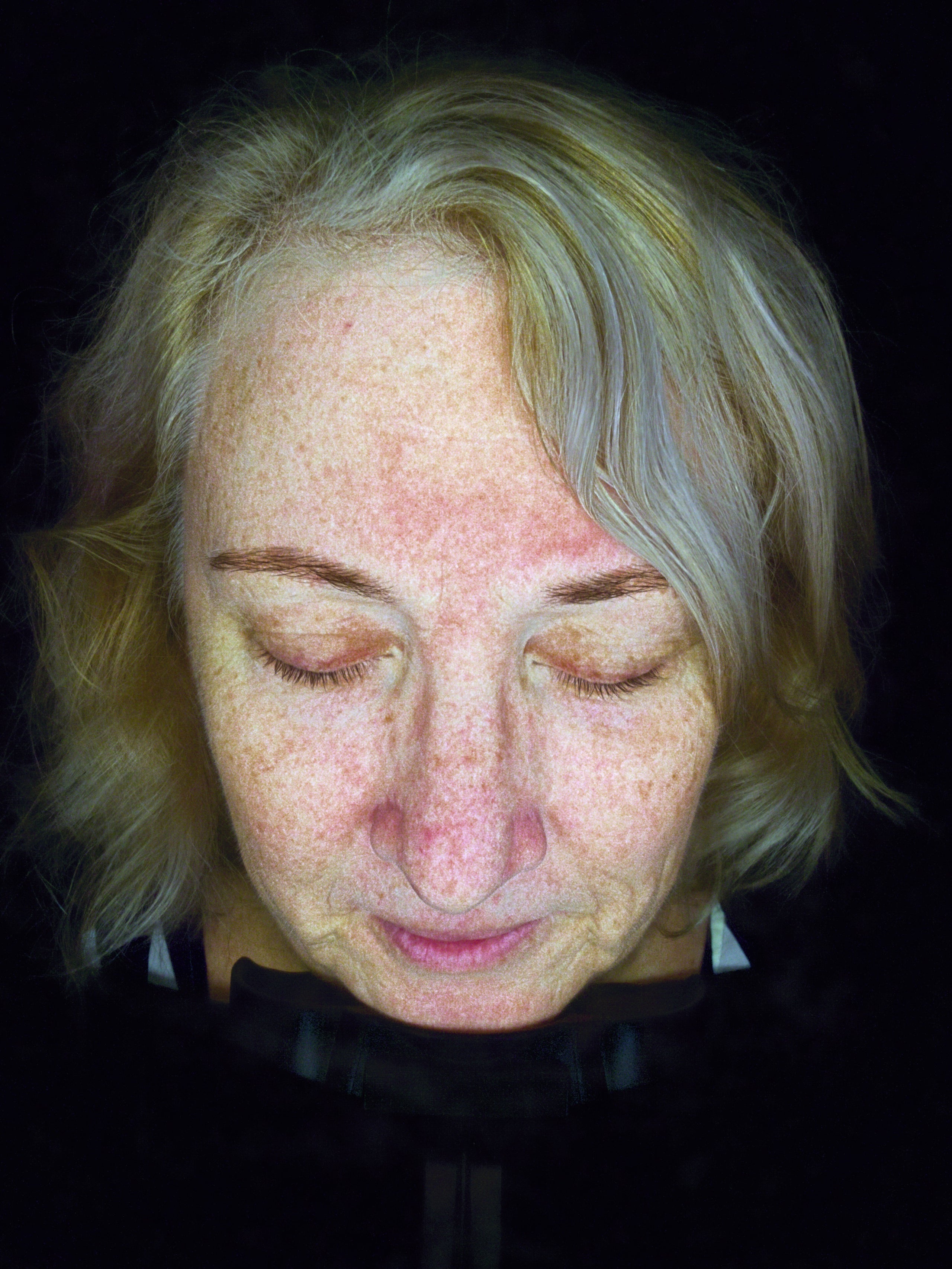 Pigmentation & Discoloration – Hawthorne Skin & Beauty